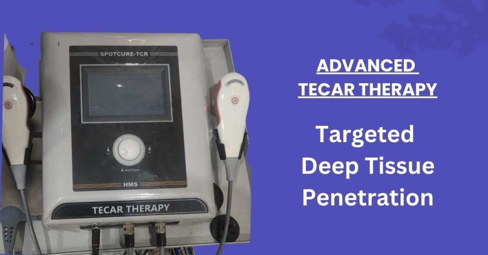 TECAR Therapy - Dr. Aggarwal Physio Centre